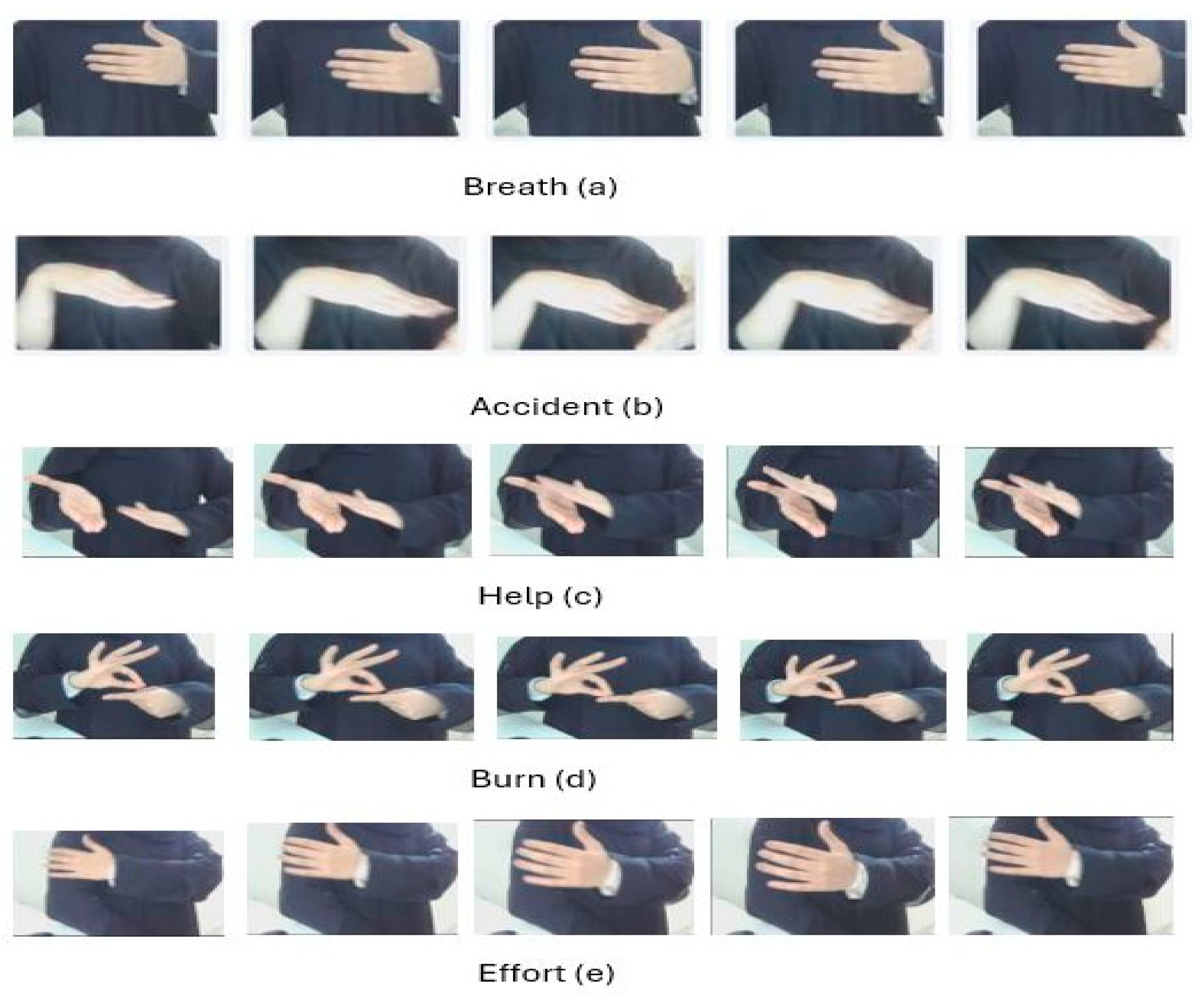 Hybrid Deep Learning Models for Arabic Sign Language Recognition in Healthcare Applications