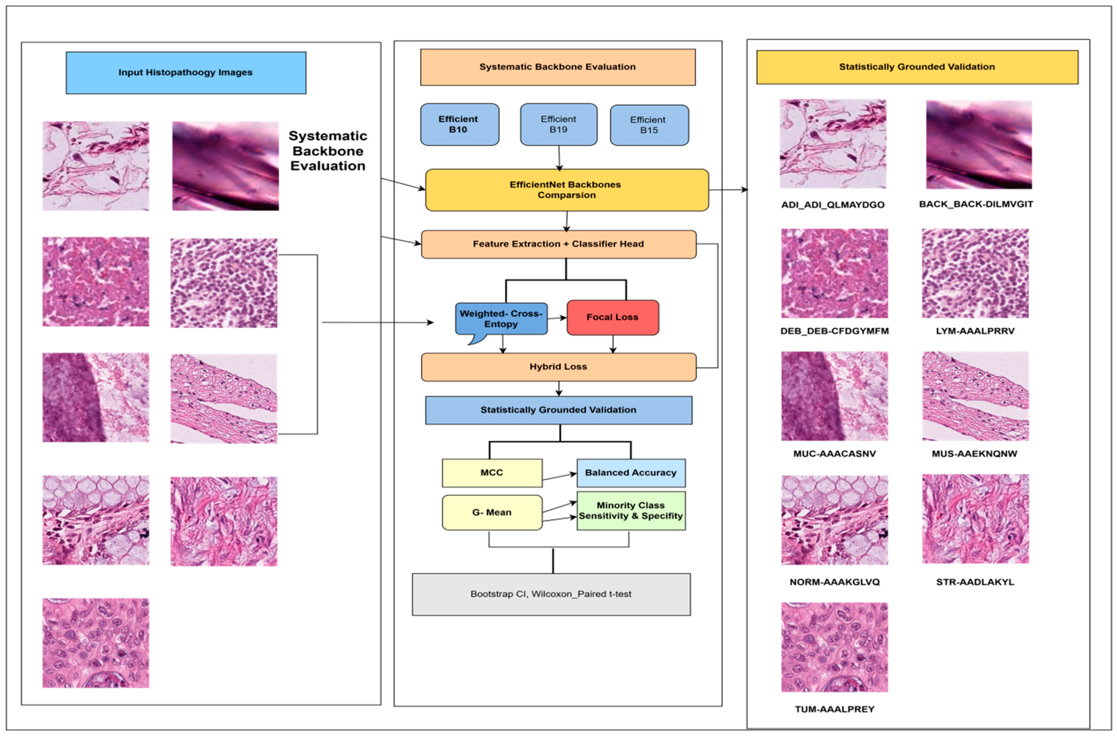 Hybrid Loss-Based Deep Learning Framework Using EfficientNet-B3 for ...