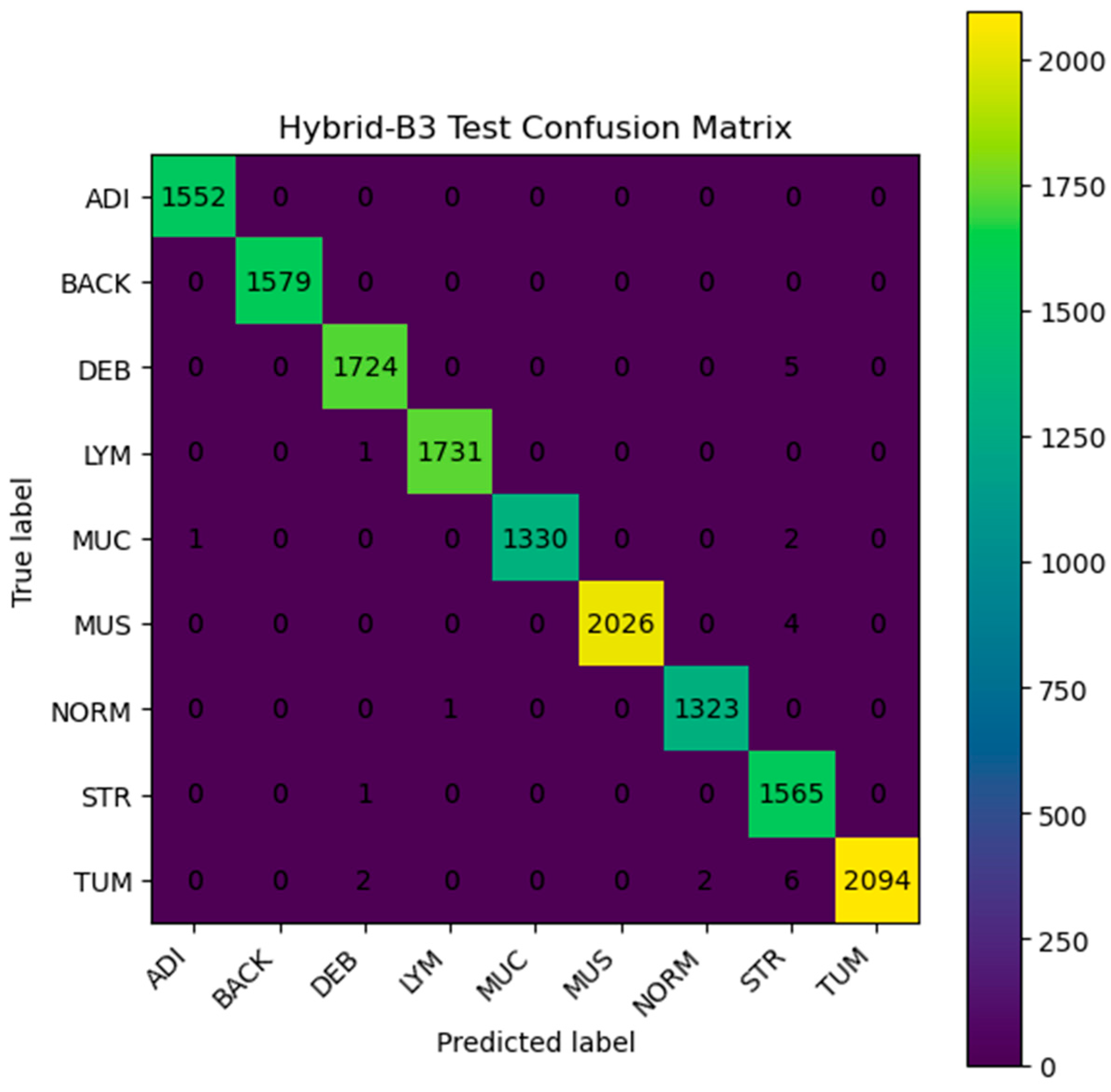 Hybrid Loss-Based Deep Learning Framework Using EfficientNet-B3 for ...