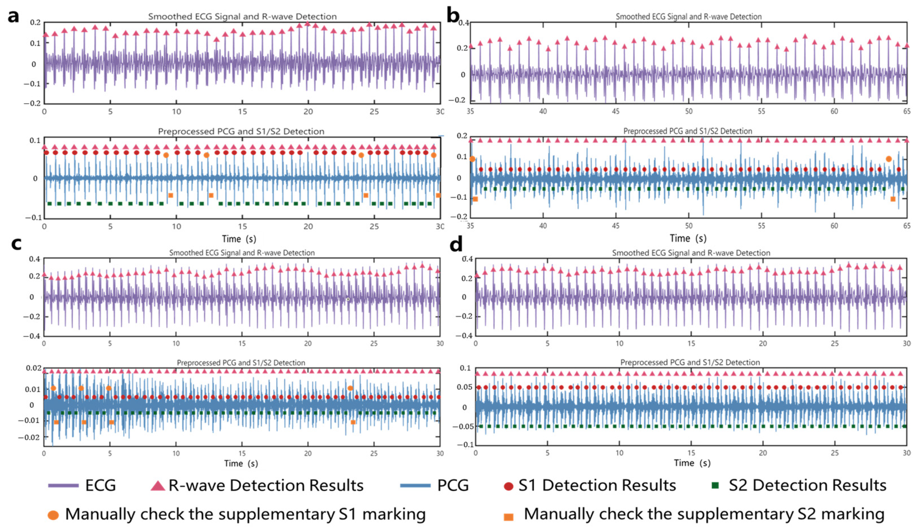 An Automated ECG-PCG Coupling Analysis System with LLM-Assisted ...