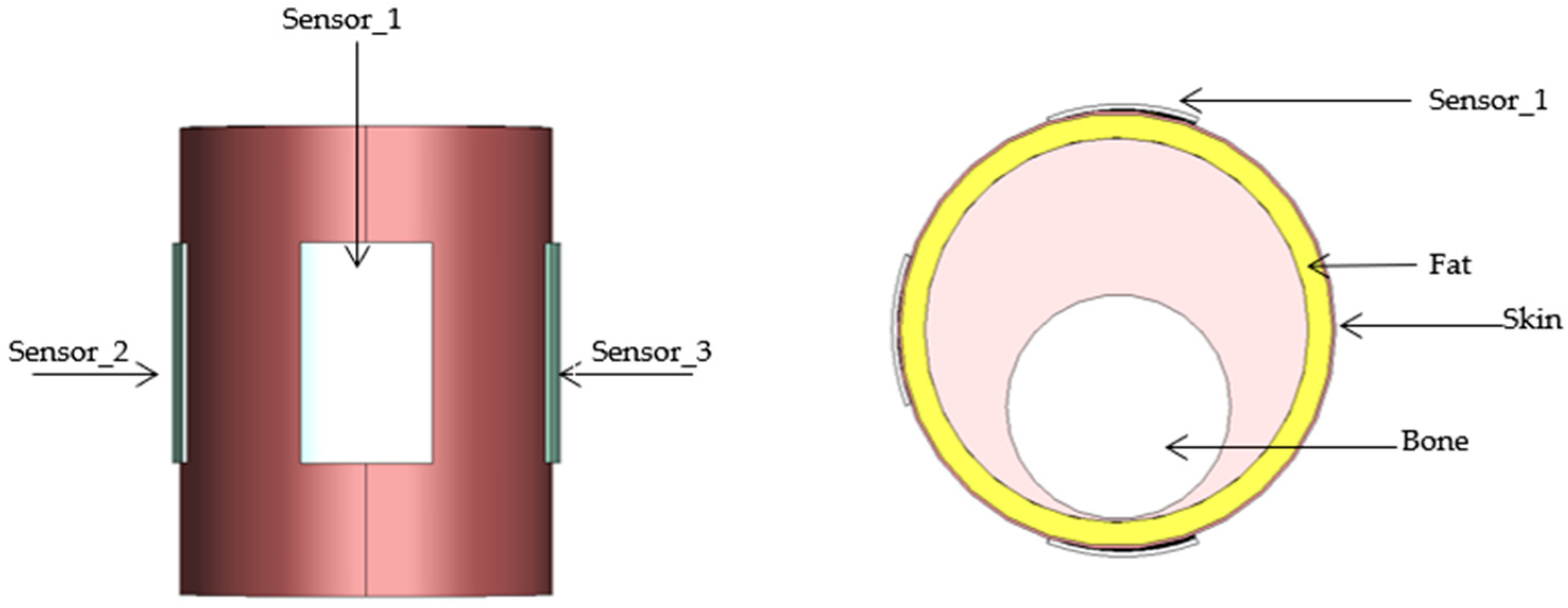 A Physics-Guided Machine Learning Algorithm for Non-Ionizing Femur ...