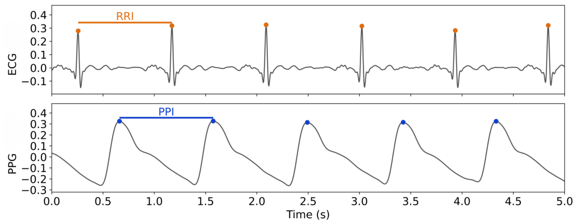 Full-Night Comparison of ECG- and PPG-Derived Measures of Cardiac ...