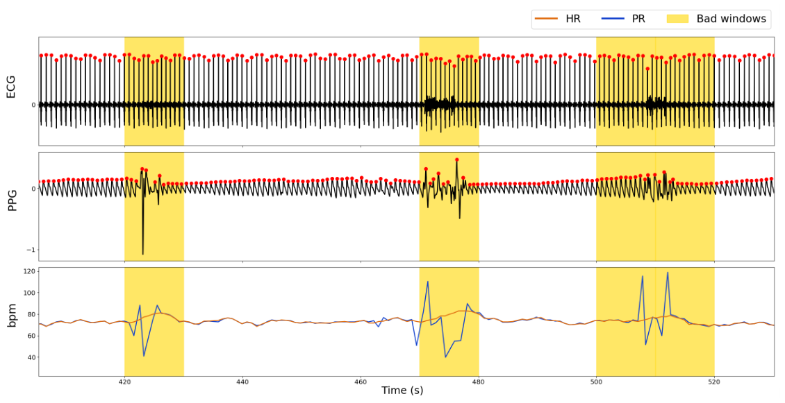 Full-Night Comparison of ECG- and PPG-Derived Measures of Cardiac ...