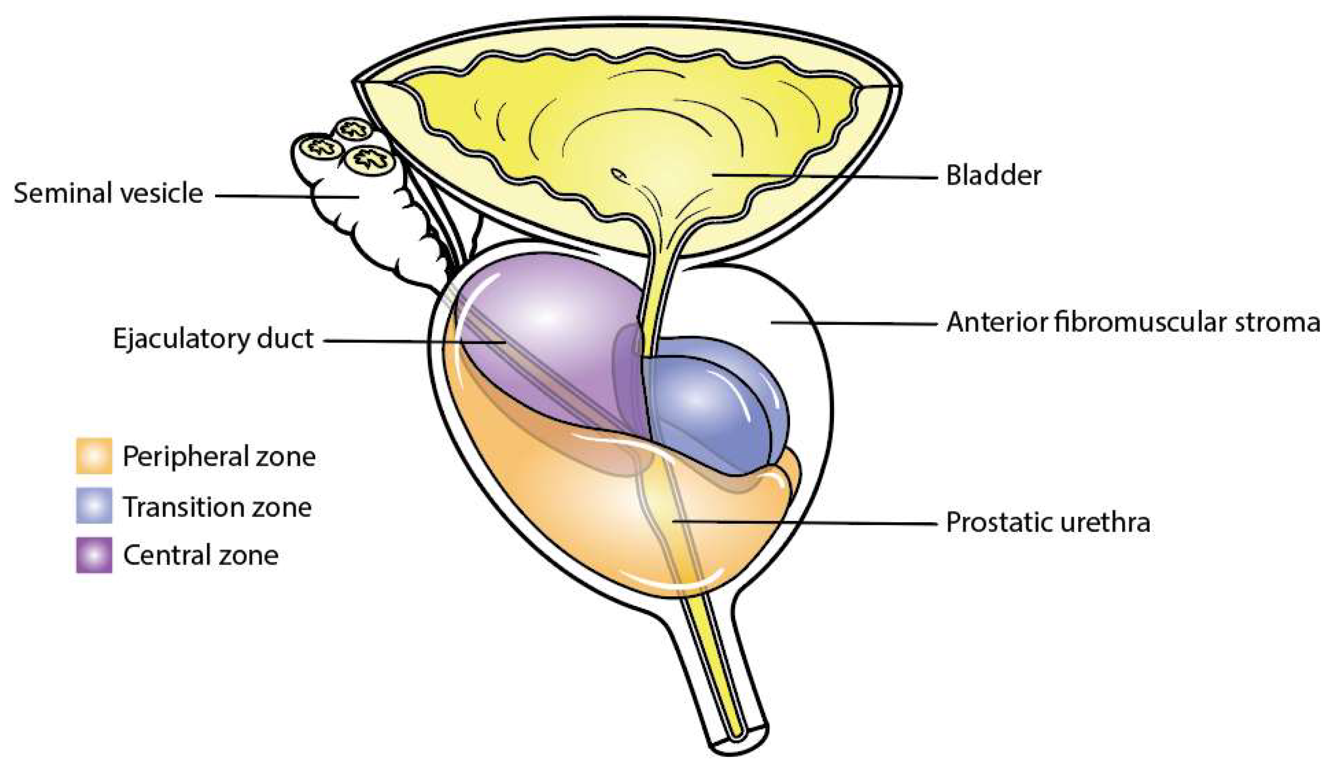 Prostate Gland Zones Prostate Gland Zones