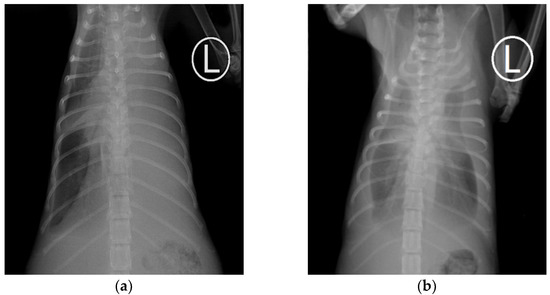 A Retrospective Study on Bacteriology, Clinicopathologic and ...