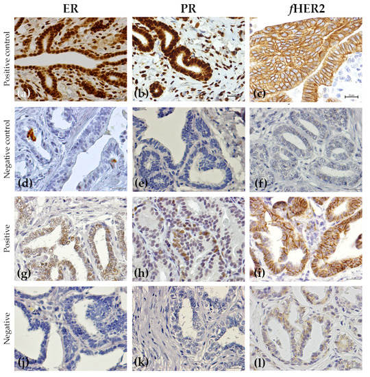 fHER2, PR, ER, Ki-67 and Cytokeratin 5/6 Expression in Benign Feline ...