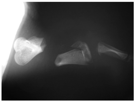 Bone Healing Process of a Multiple Humeral Fracture in a Caretta ...
