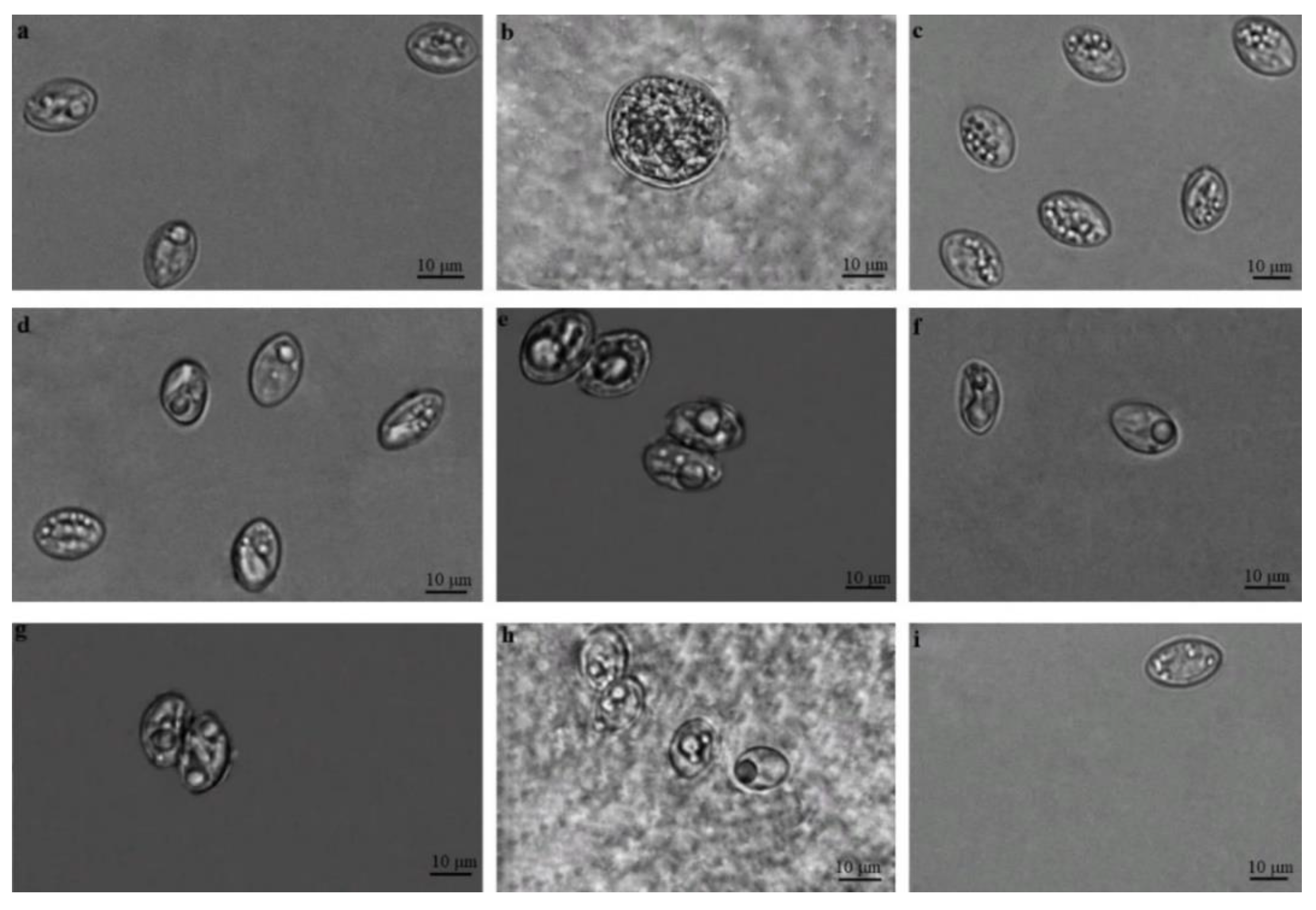 Sarcocystis Parasites Sarcocystis Parasites