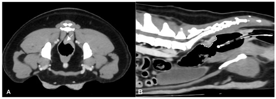 Role of CT in the Staging of Colorectal Tumors: A Preliminary Study on ...