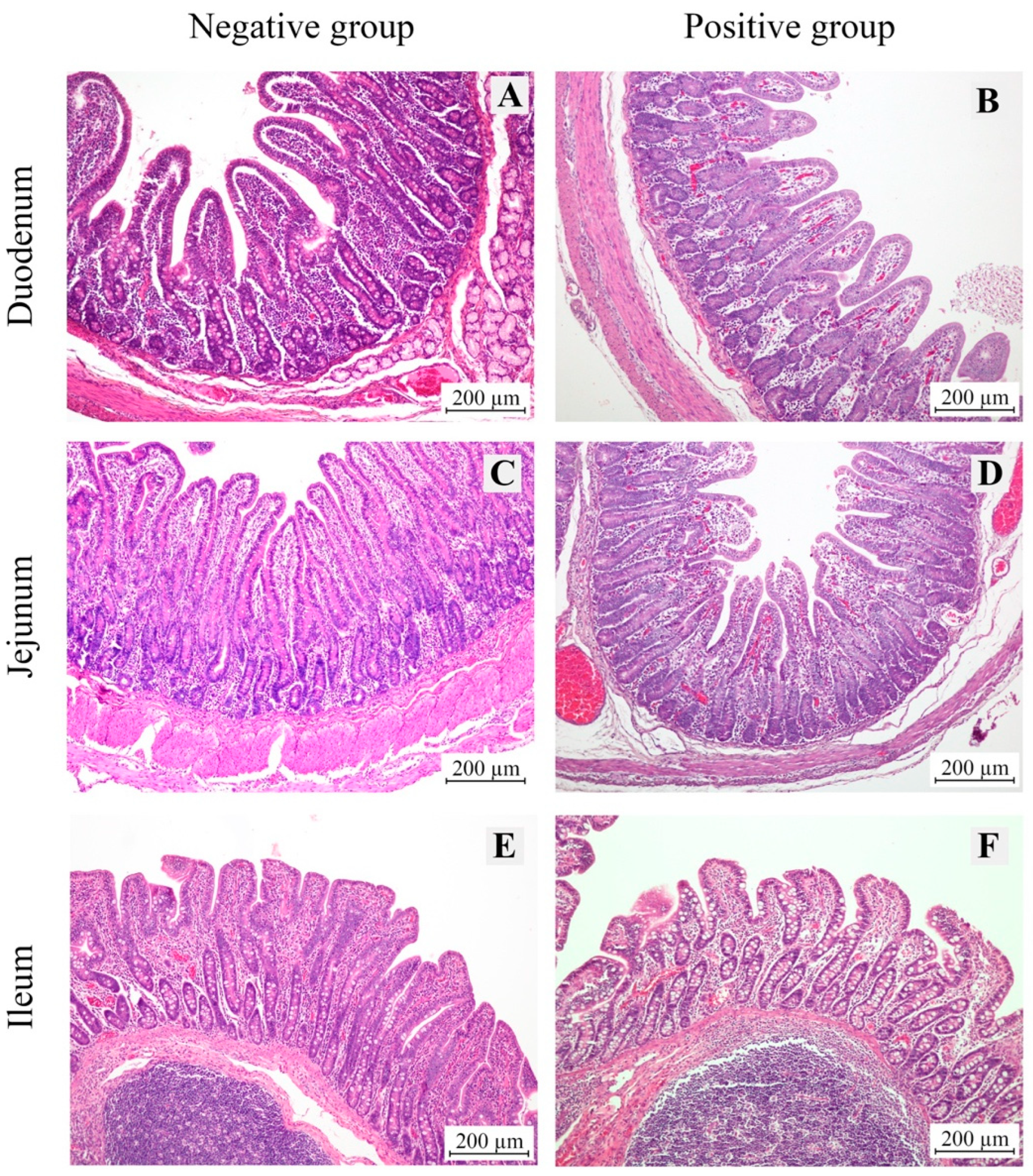 Intestinal Alkaline Phosphatase Expression in Response to Escherichia ...