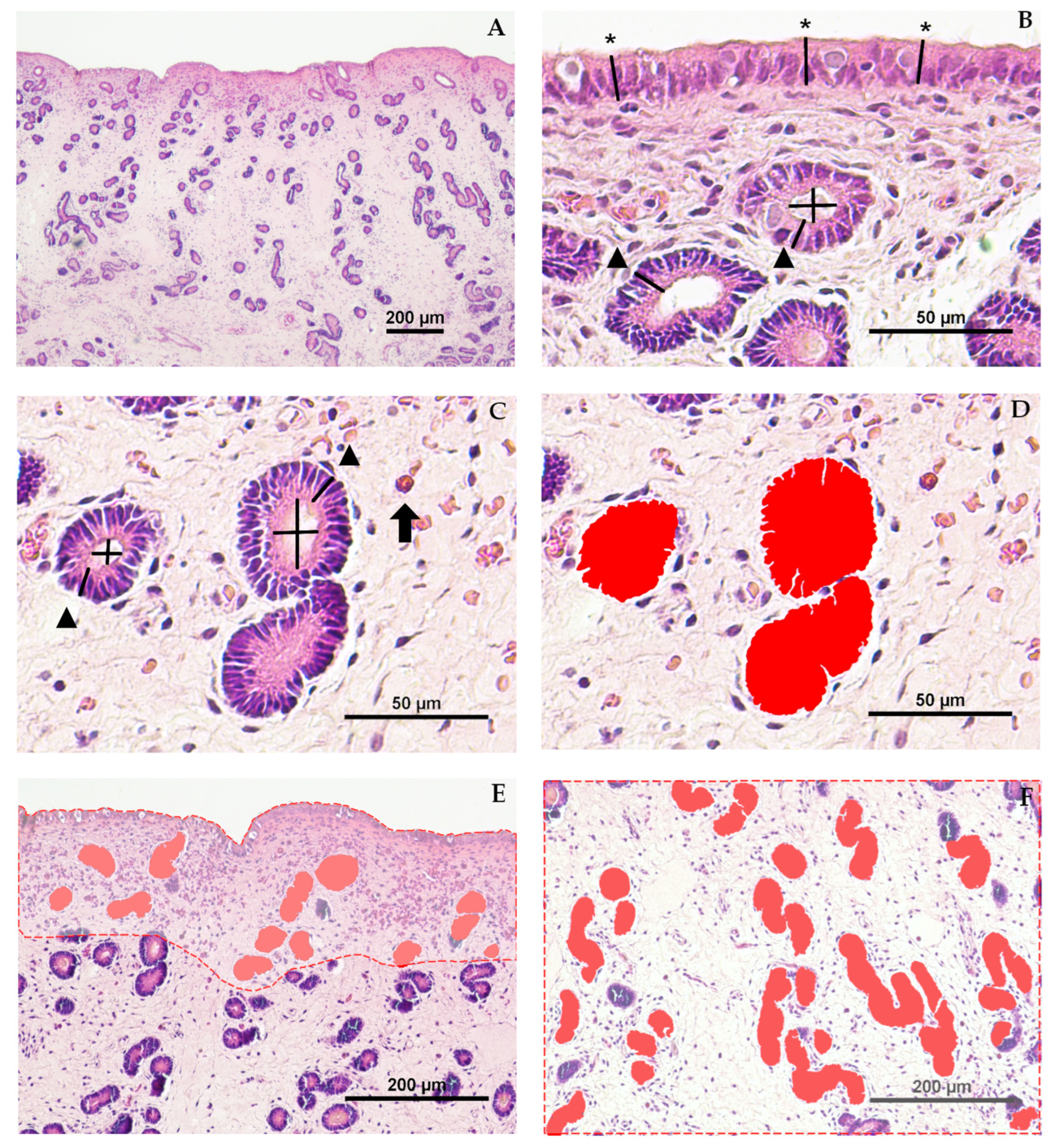Histomorphometric Analysis of the Endometrium of Jennies (Equus asinus ...