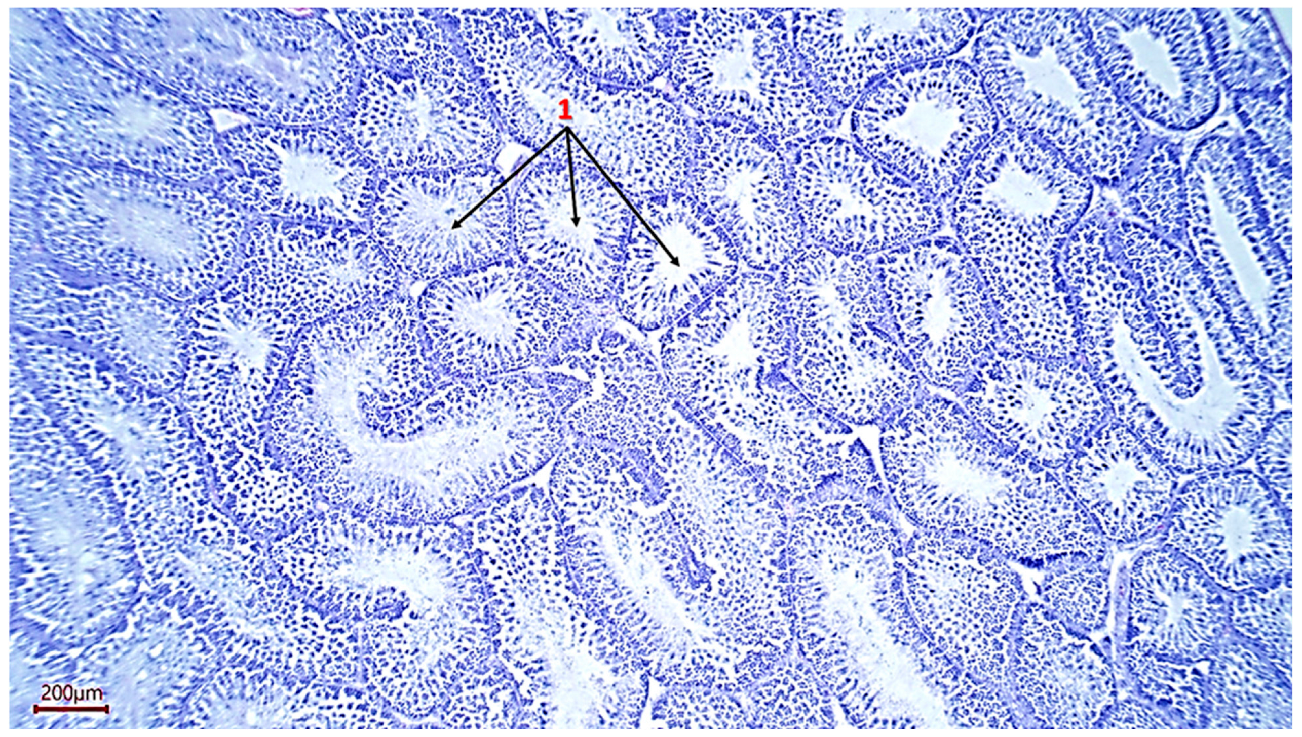 Integrated Analysis of Testicular Histology, Sperm Quality, and Gene ...