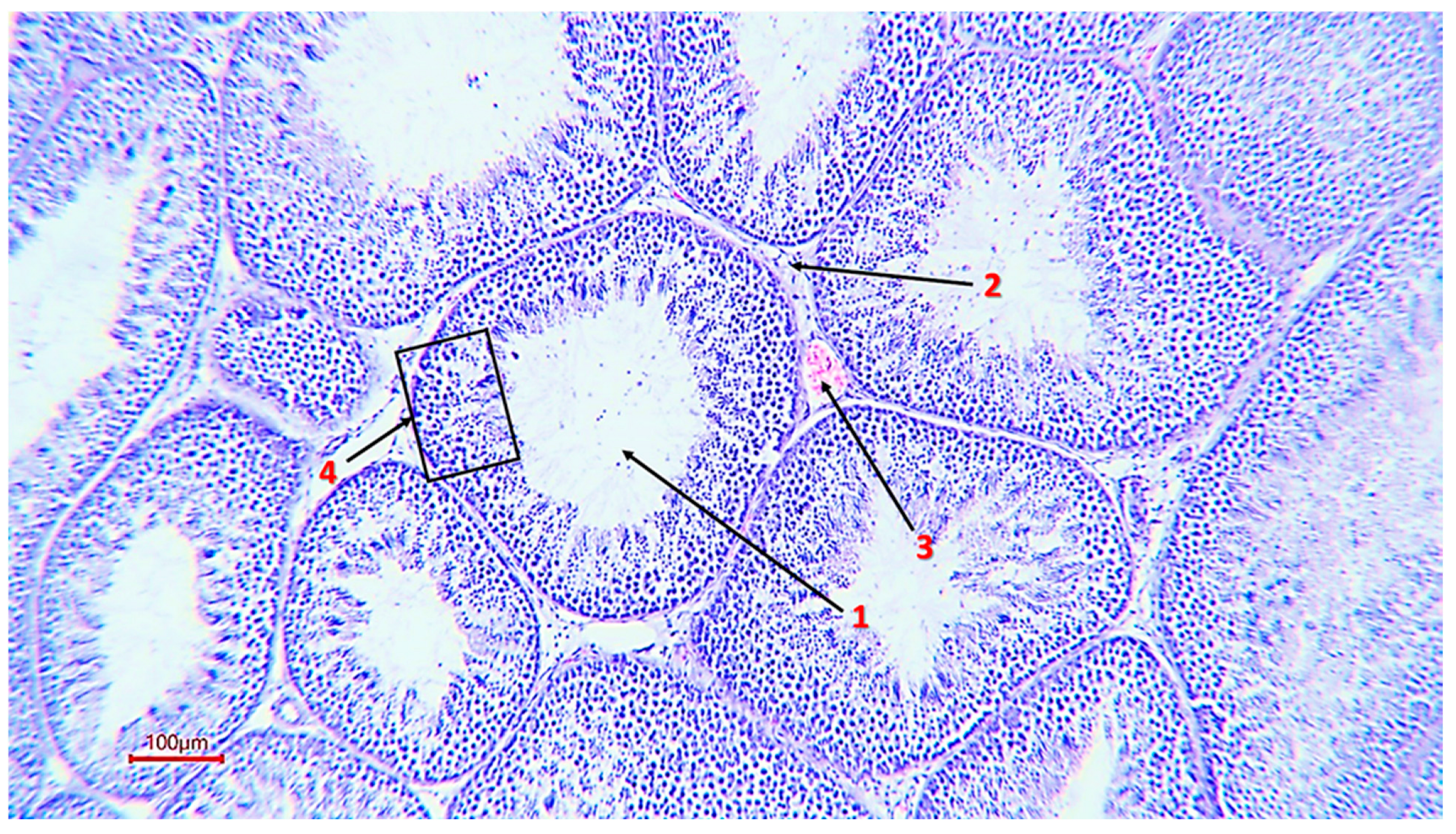 Integrated Analysis of Testicular Histology, Sperm Quality, and Gene ...
