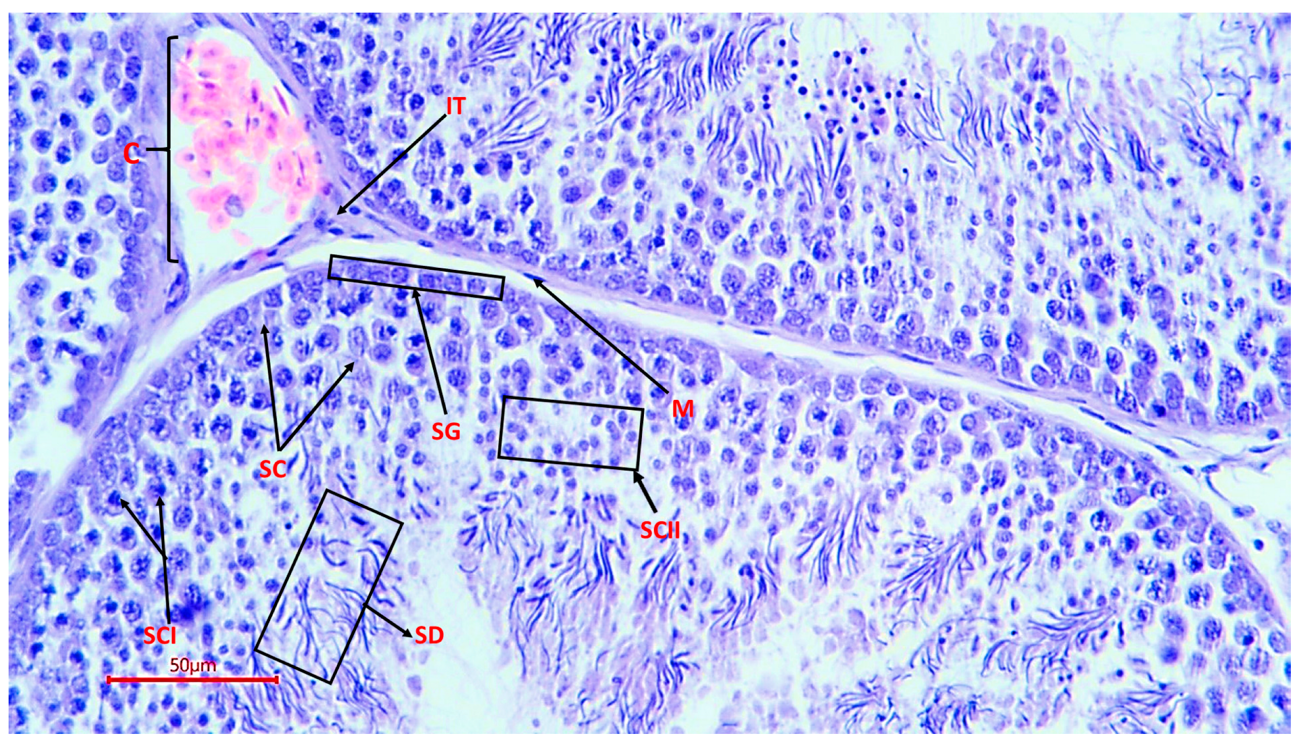 Integrated Analysis of Testicular Histology, Sperm Quality, and Gene ...