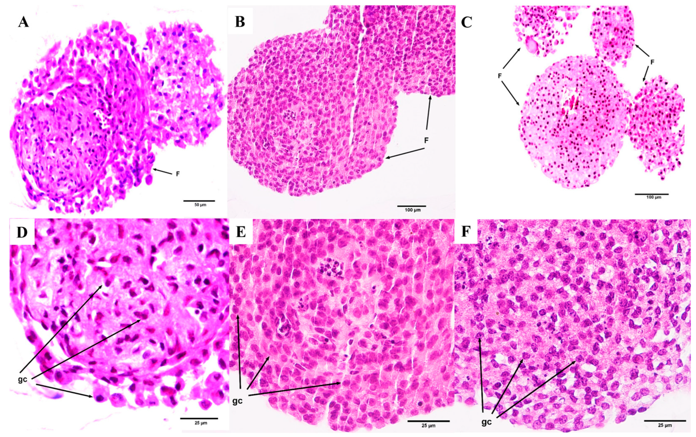 Optimization of Sodium Alginate Concentration and Evaluation of ...
