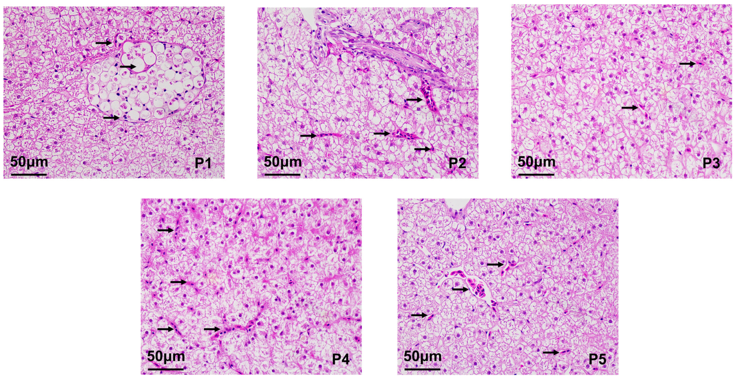 Dietary Protein Requirement of Juvenile Tor sinensis Based on Growth ...