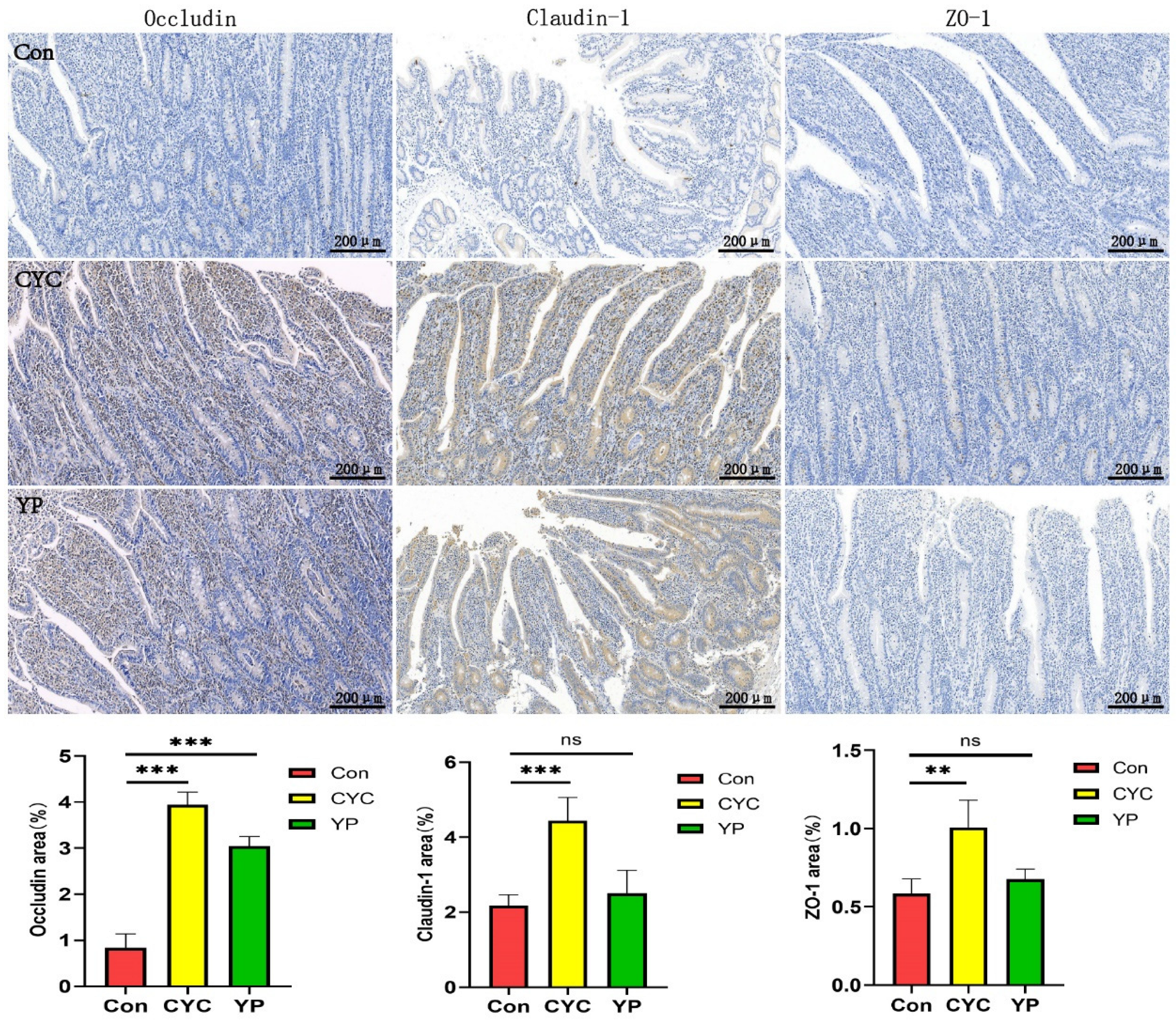 Effects of Compound Yeast Culture and Yeast Cell Wall Polysaccharide on ...
