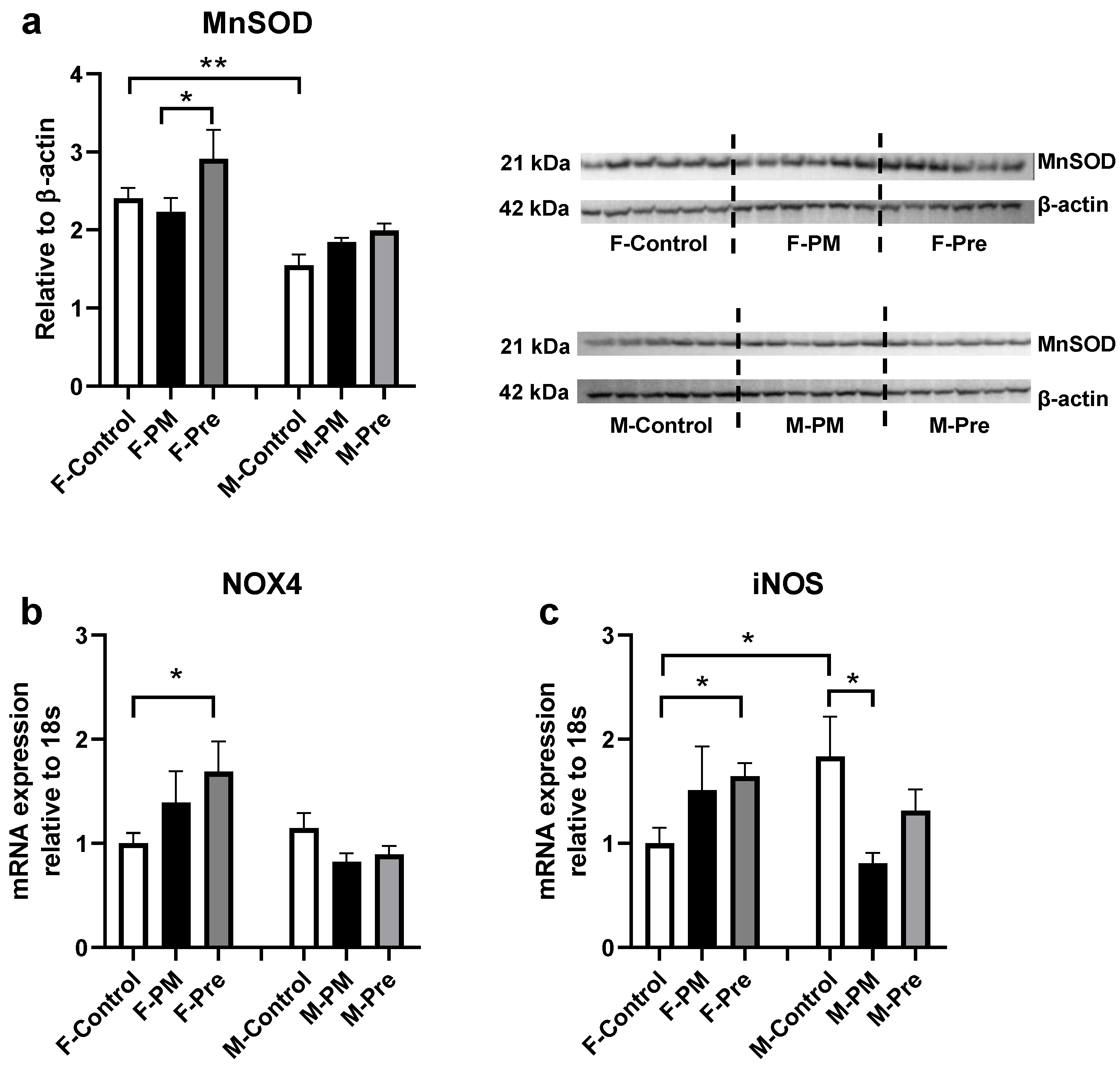 Antioxidants Free Full Text Sex Dependent Responses To Maternal