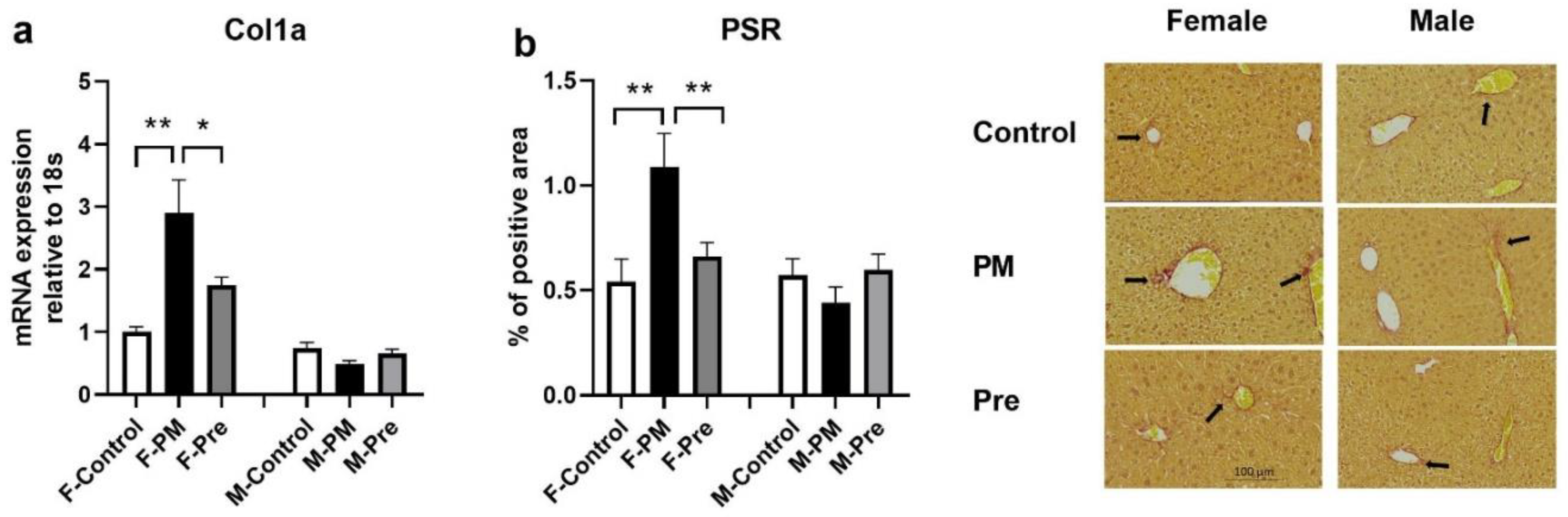 Antioxidants Free Full Text Sex Dependent Responses To Maternal
