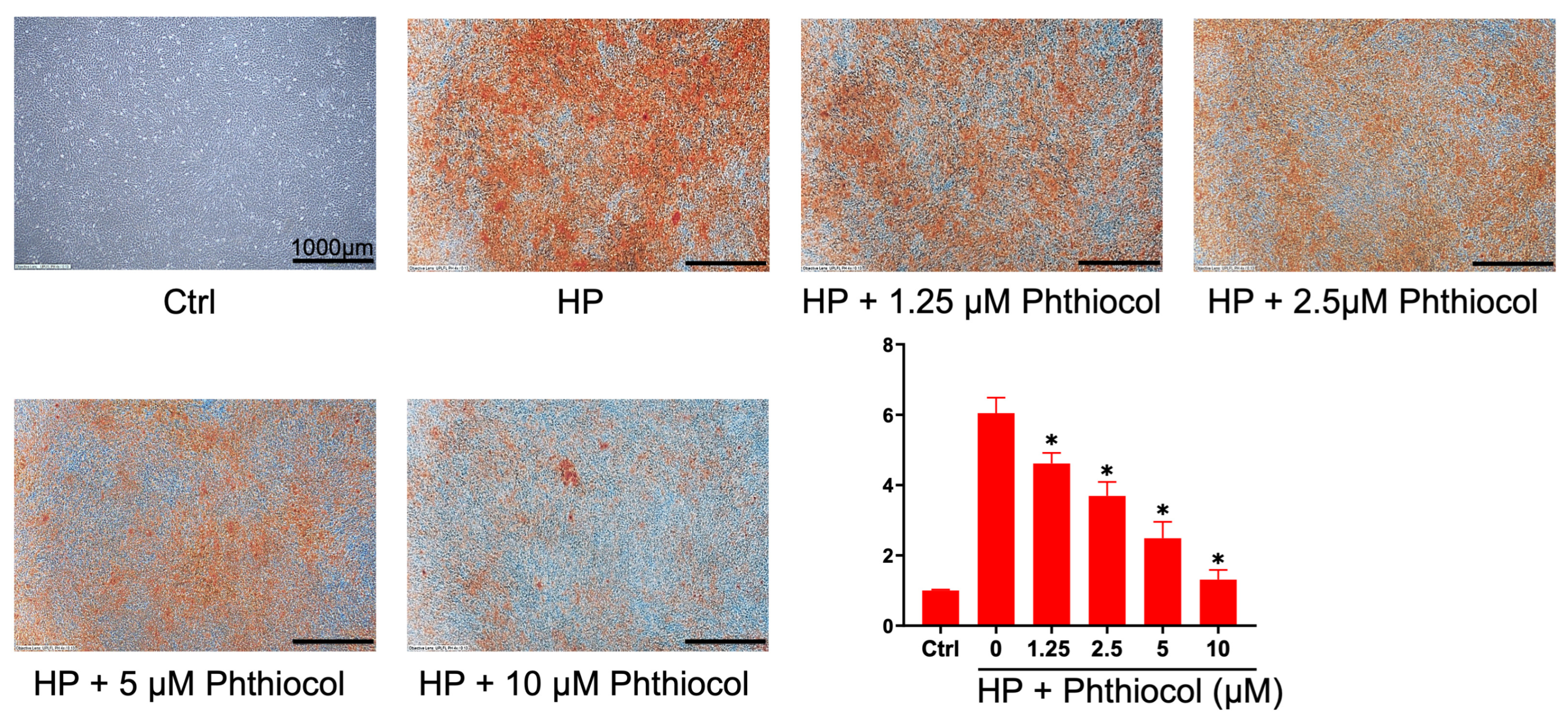 Vitamin K3 Analog Phthiocol Protects Against High Phosphate-Induced ...