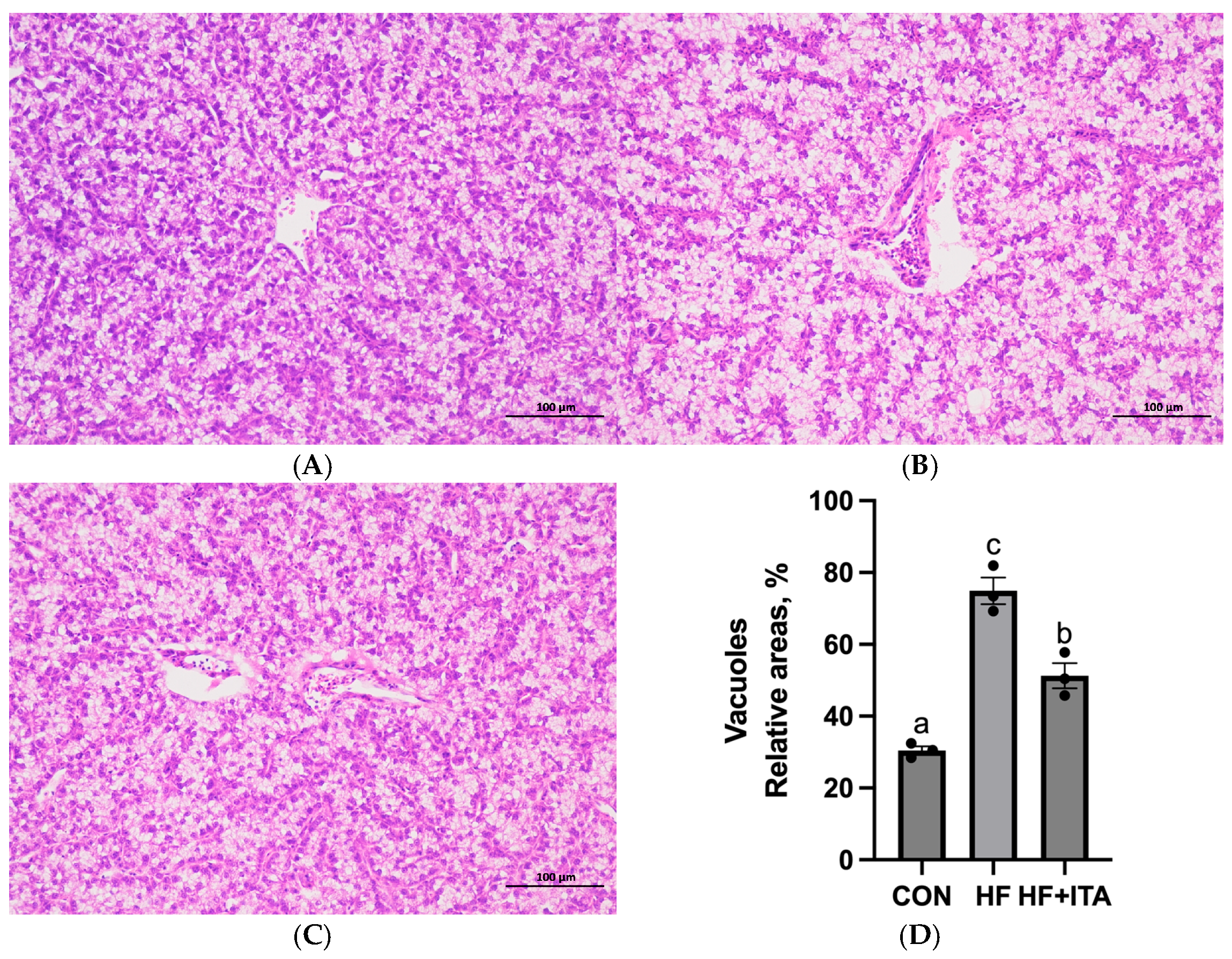 Itaconic Acid Activates Lysosomal Biogenesis and Autophagy Flux and ...