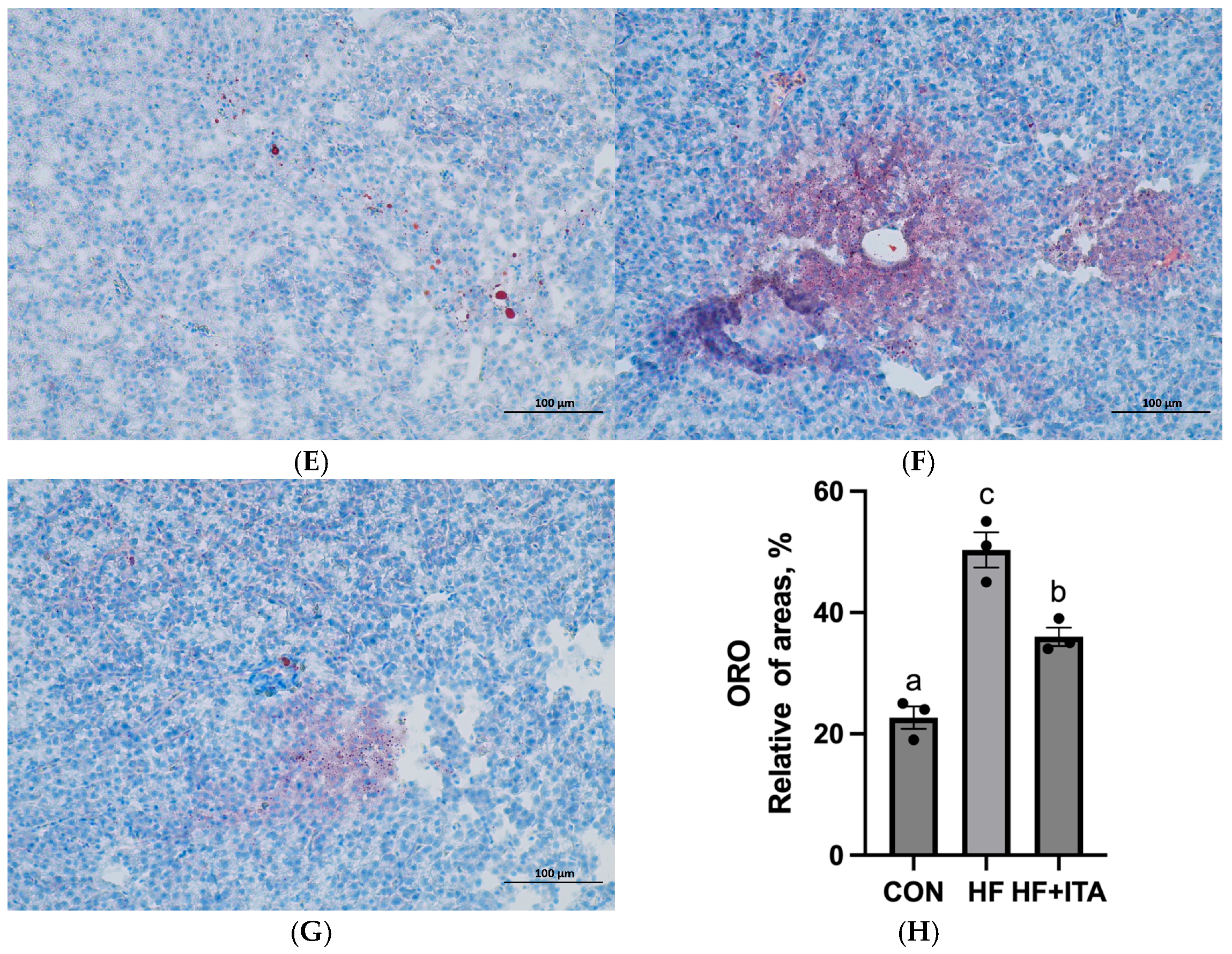 Itaconic Acid Activates Lysosomal Biogenesis and Autophagy Flux and ...