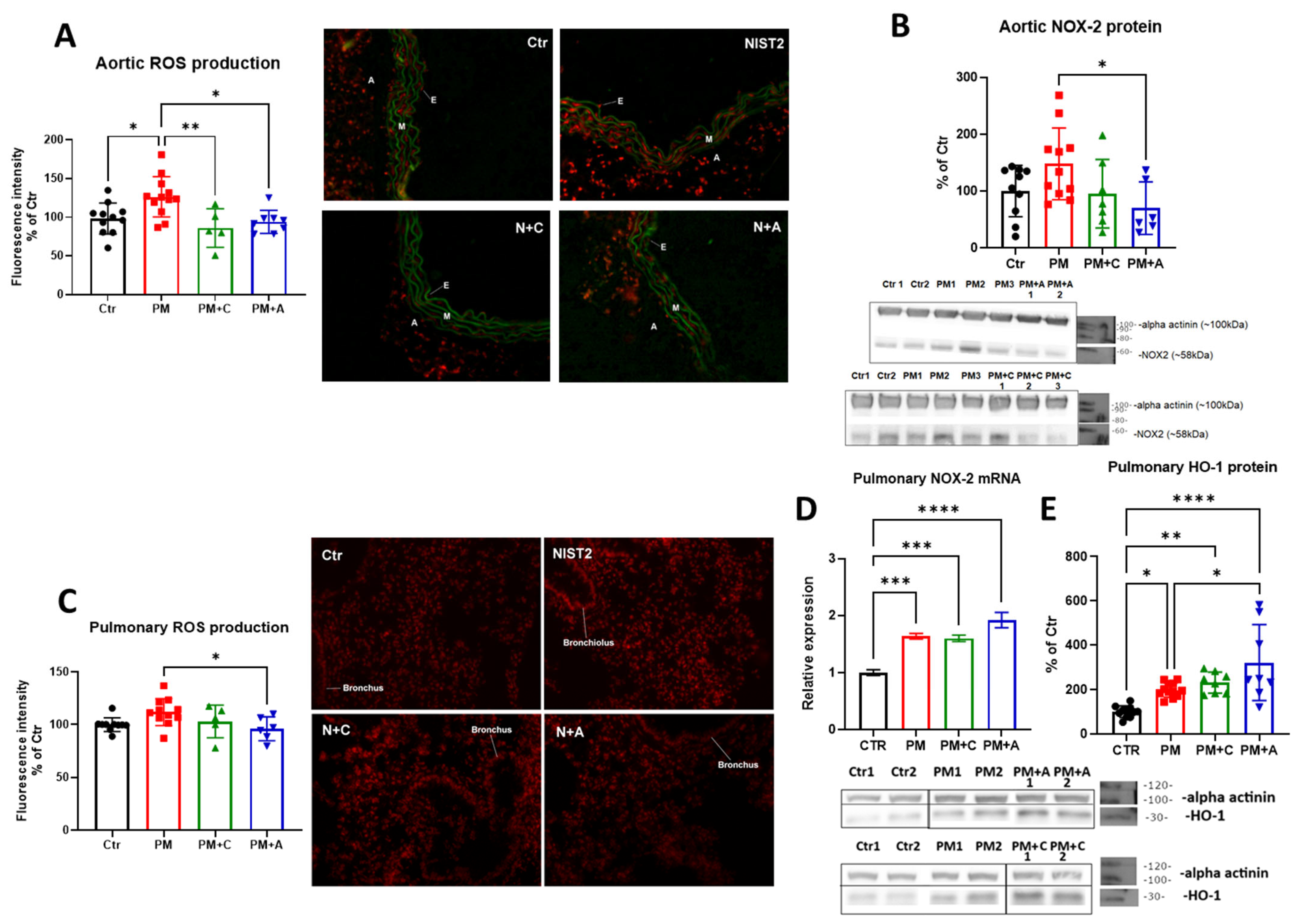 Angiotensin-Converting Enzyme (ACE) Inhibitors and Statins Mitigate ...
