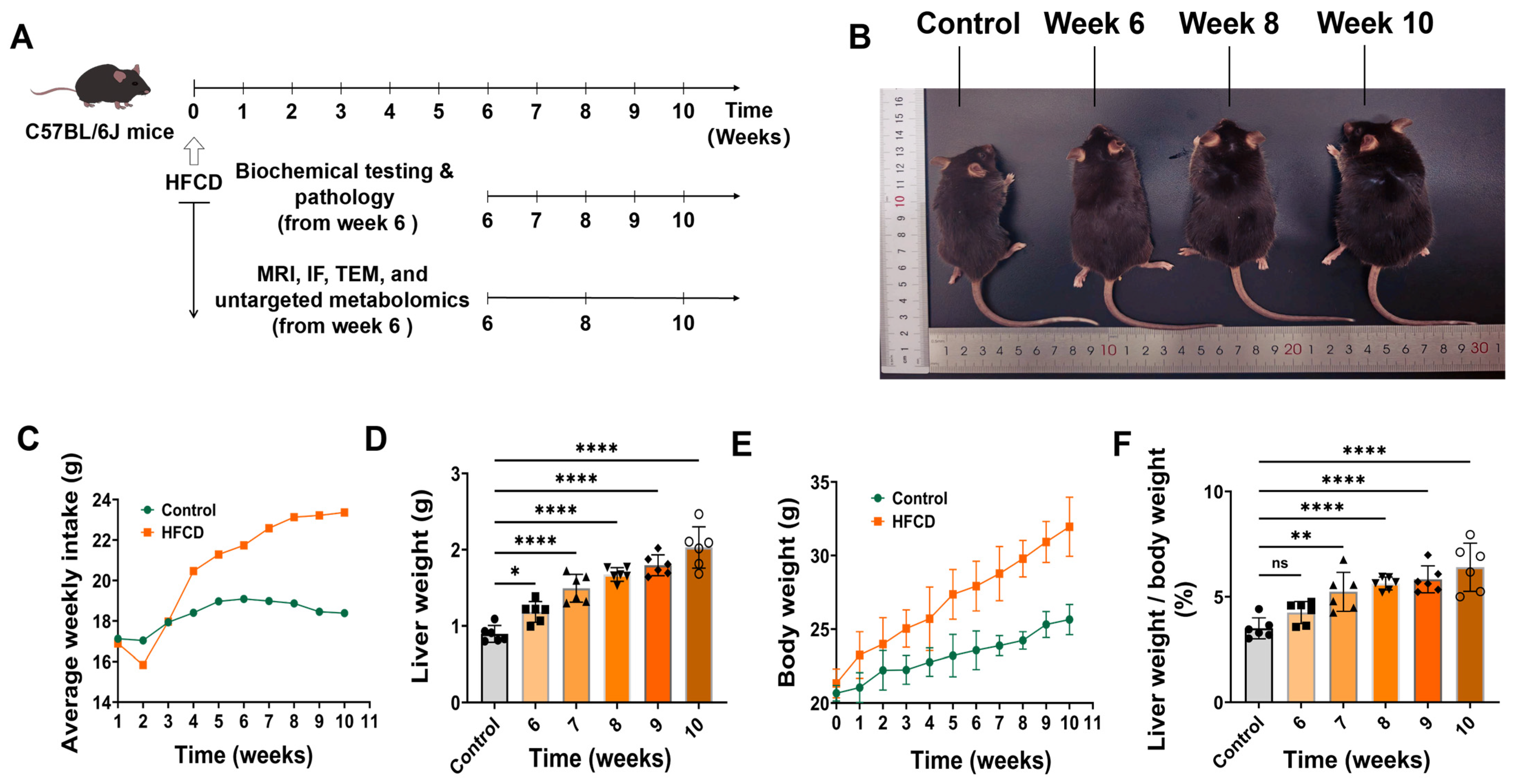 Choline Deficiency Drives the Inflammation–Fibrosis Cascade: A ...