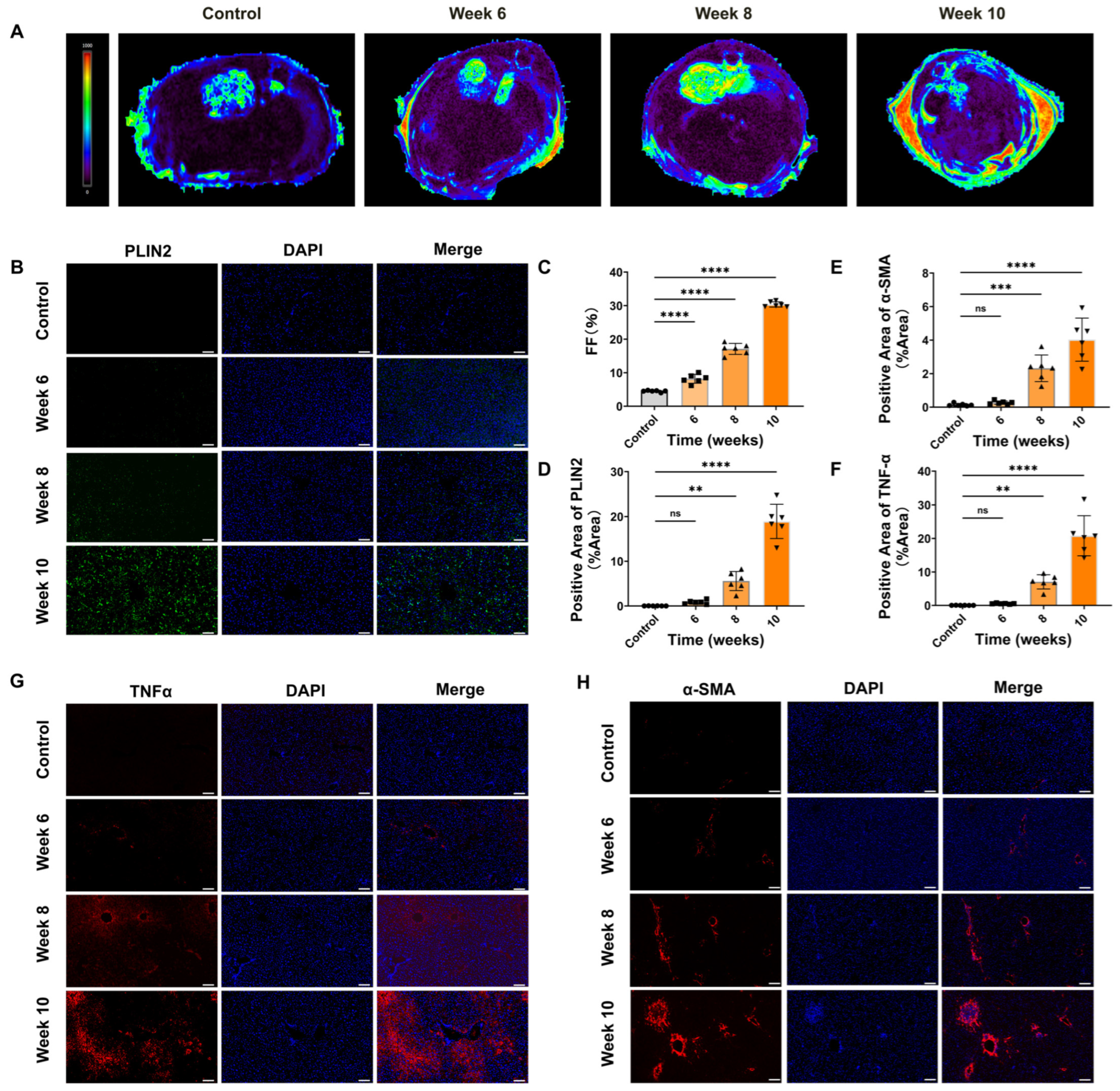 Choline Deficiency Drives the Inflammation–Fibrosis Cascade: A ...