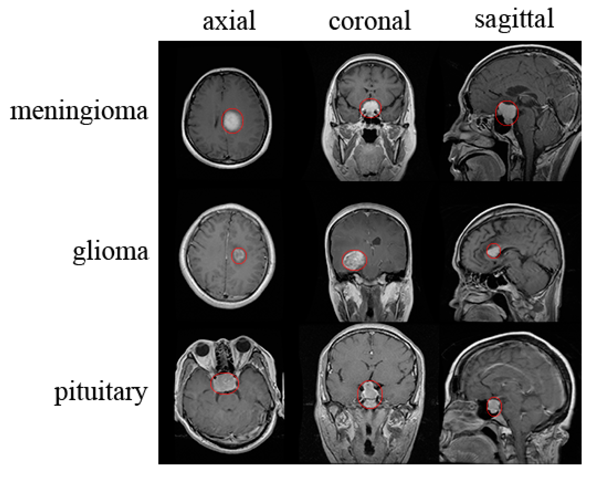 Classification Of Brain Tumors From MRI Images Using A Convolutional Classification Of Brain Tumors From MRI Images Using A Convolutional