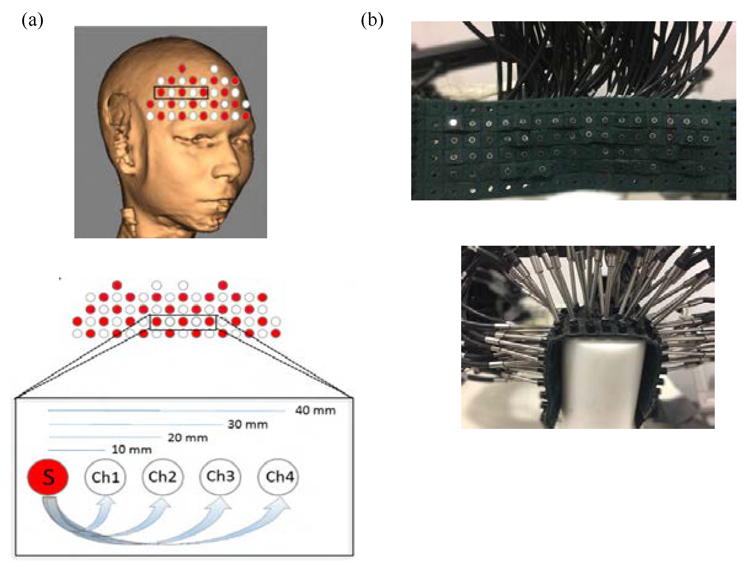 Diffuse Optical Tomography Using Bayesian Filtering in the Human Brain