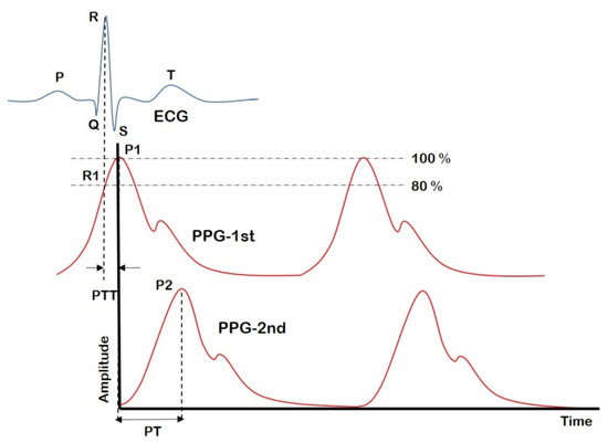 Blood Pressure Estimation Algorithm Based on Photoplethysmography Pulse ...