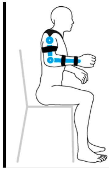 A Review on Upper Limb Rehabilitation Robots