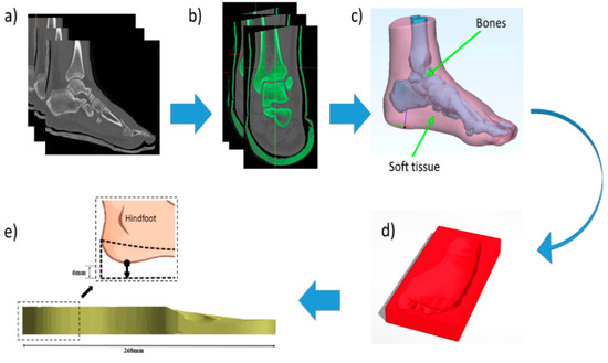 Effects of Custom-Made Insole Materials on Frictional Stress and ...