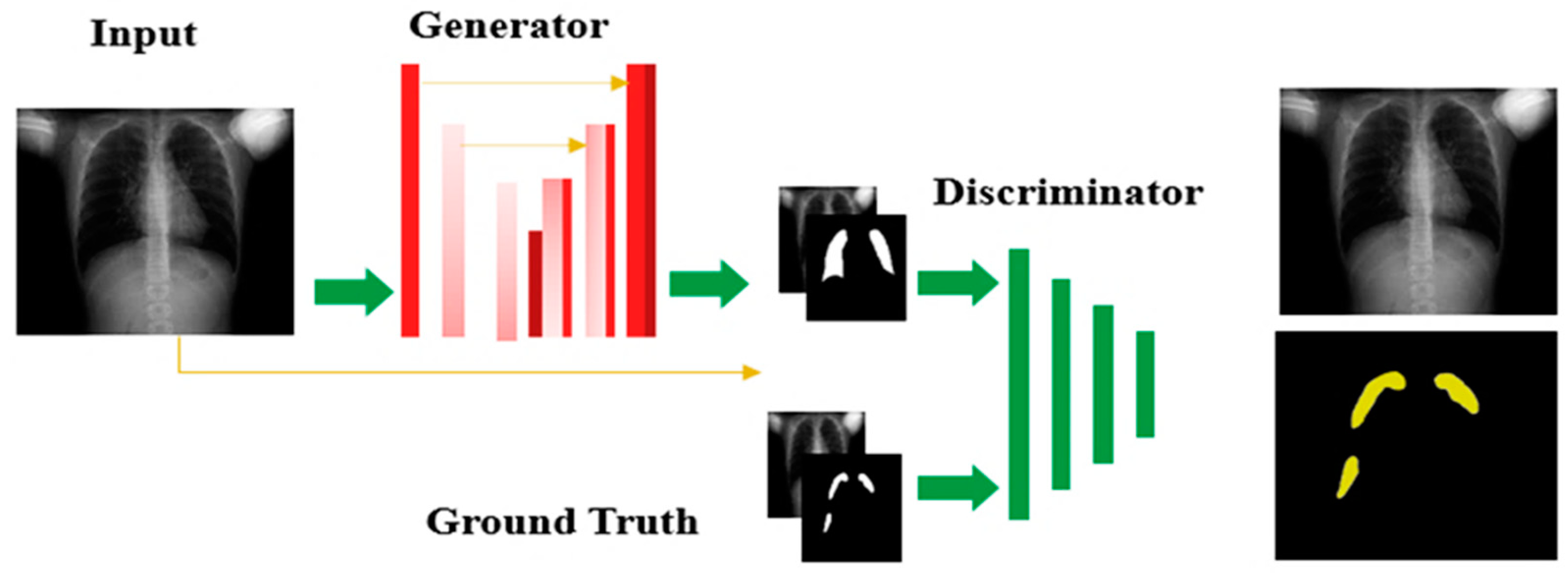 Applied Sciences | Free Full-Text | Lung’s Segmentation Using Context-Aware Regressive ...