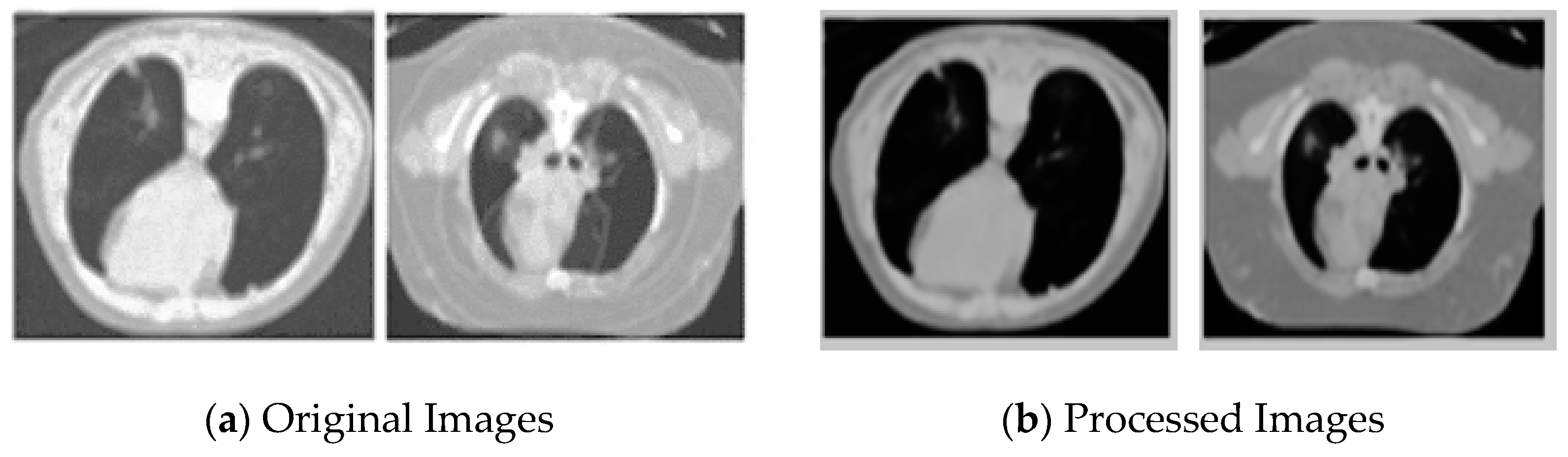 Applied Sciences | Free Full-Text | Lung’s Segmentation Using Context-Aware Regressive ...