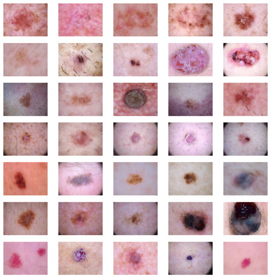 Robustness, Stability, and Fidelity of Explanations for a Deep Skin ...