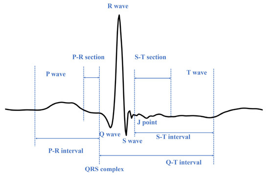 Improving ECG Classification Performance by Using an Optimized One ...