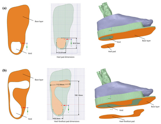 The Effect of Customized Insole Pads on Plantar Pressure Distribution ...
