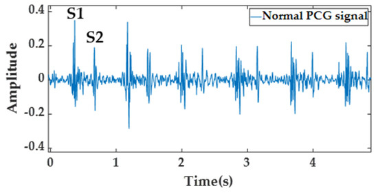 Optimal Heart Sound Segmentation Algorithm Based on K-Mean Clustering ...