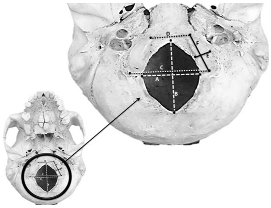 Craniometric Study and Anatomical Variations of Base of Skull in a Thai ...