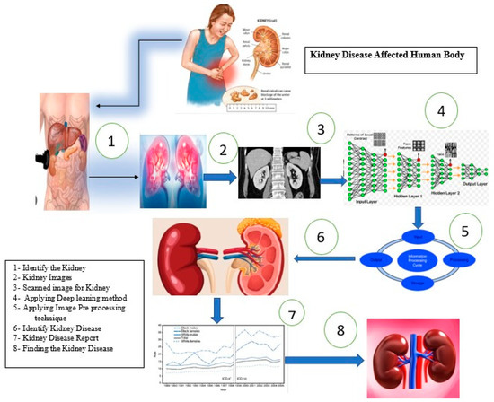 A Deep Learning Approach for Kidney Disease Recognition and Prediction through Image Processing