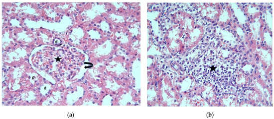 Nephrotoxicity Development of a Clinical Decision Support System Based ...
