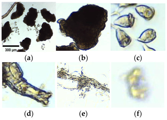 Microorganism Detection in Activated Sludge Microscopic Images Using ...