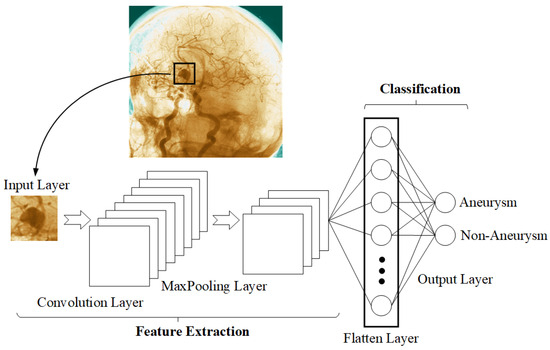 Automatic Approach for Brain Aneurysm Detection Using Convolutional Neural Networks