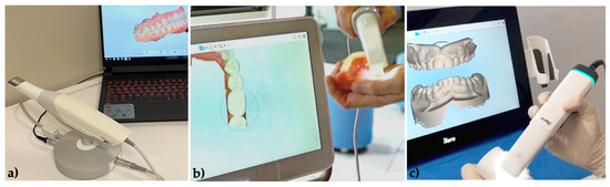 Accuracy, Time, and Comfort of Different Intraoral Scanners: An In Vivo ...