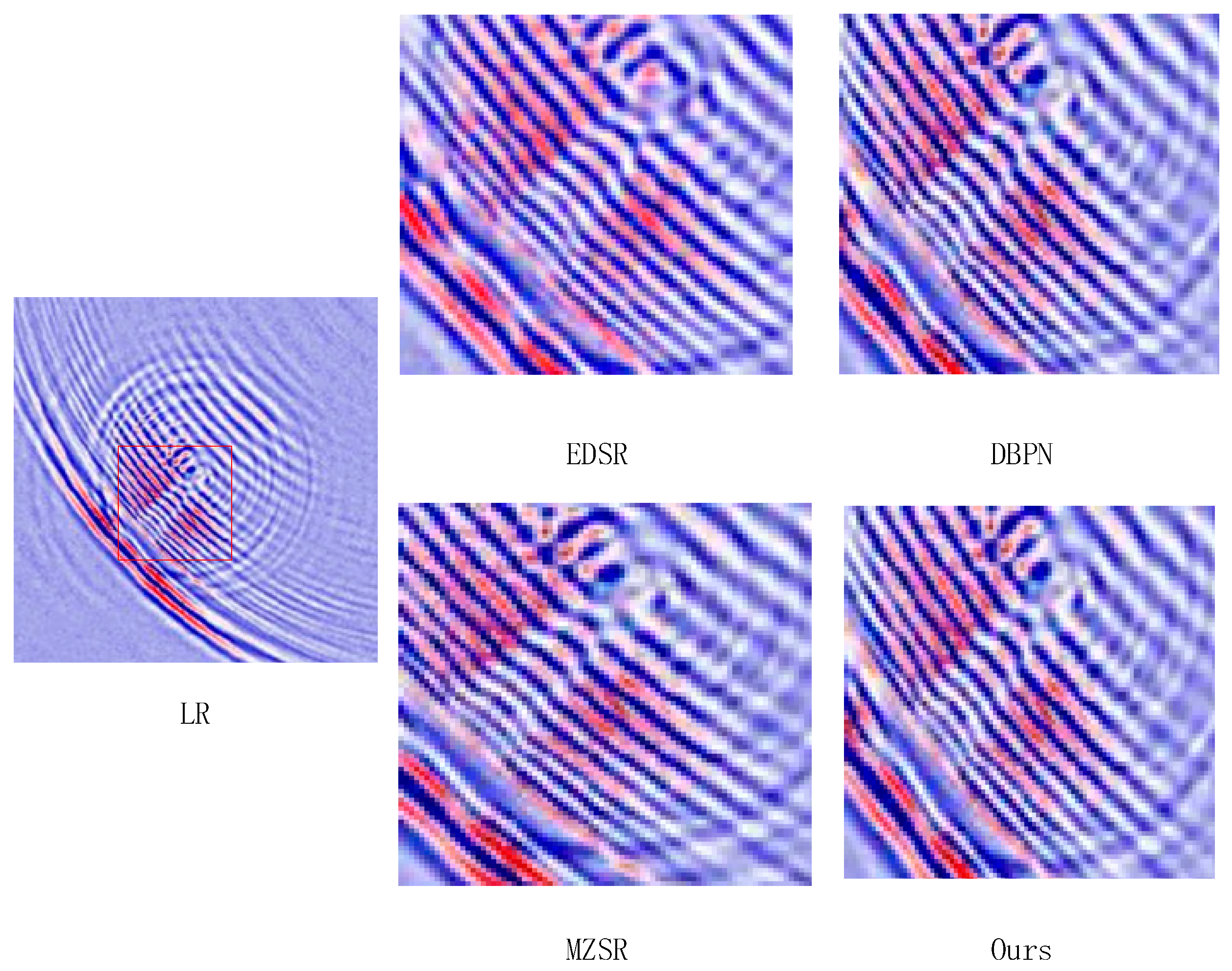 Ultrasonic Nondestructive Testing Image Enhancement Model Based on ...