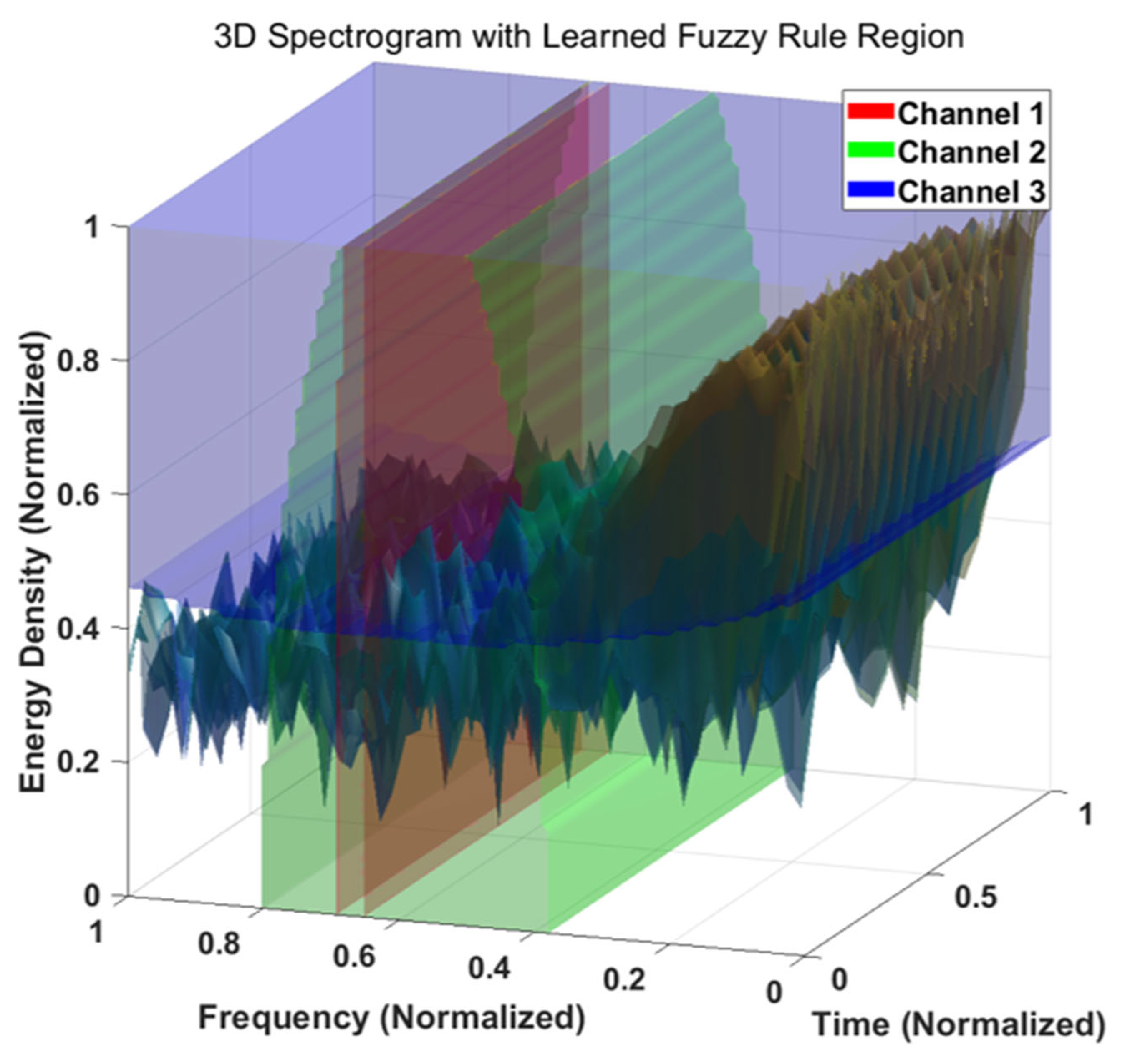 Domain Adaptation of ECG Signals Using a Fuzzy Energy–Frequency ...