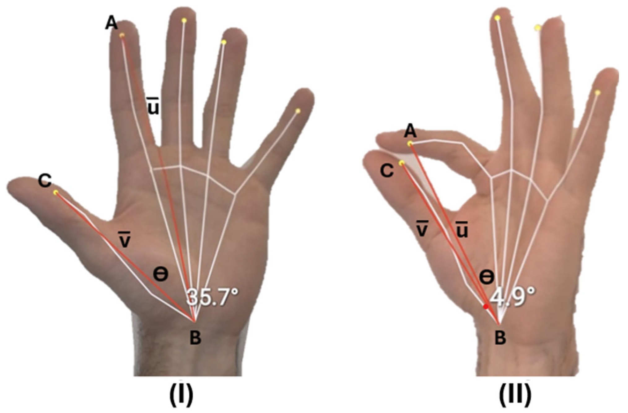 A 2D Hand Pose Estimation System Accuracy for Finger Tapping Test ...