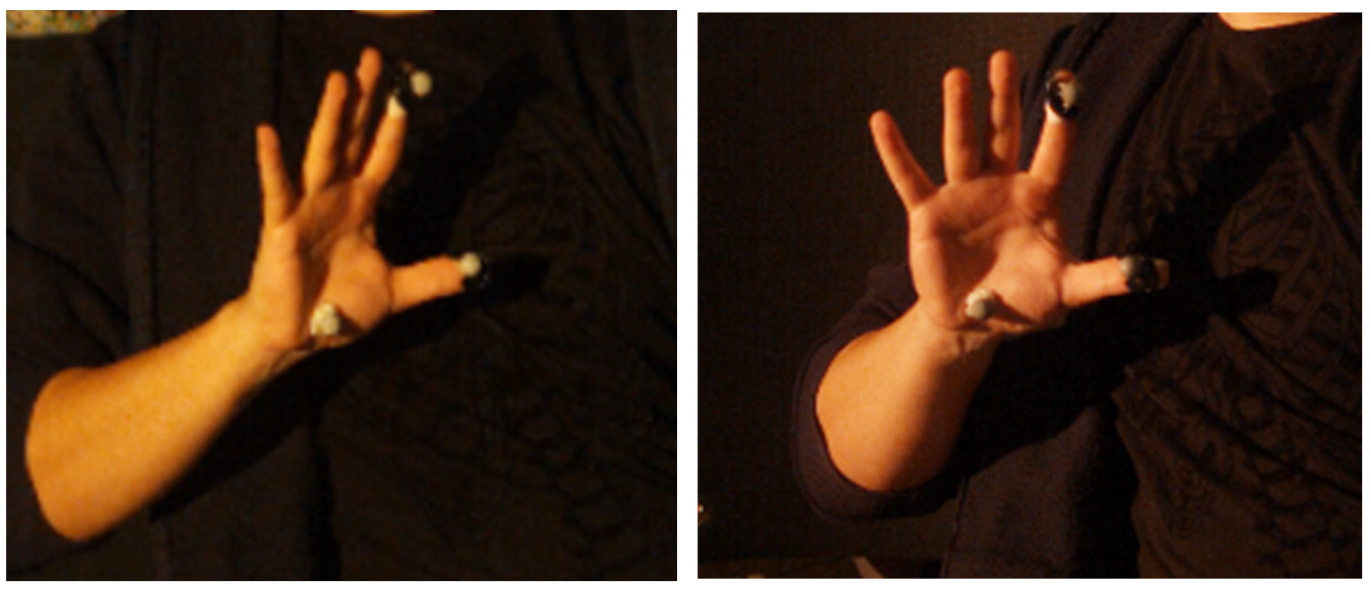 A 2D Hand Pose Estimation System Accuracy for Finger Tapping Test ...